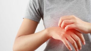 Alex 2 Allergy Test – Comprehensive Allergy Screening - Makewell Health ...